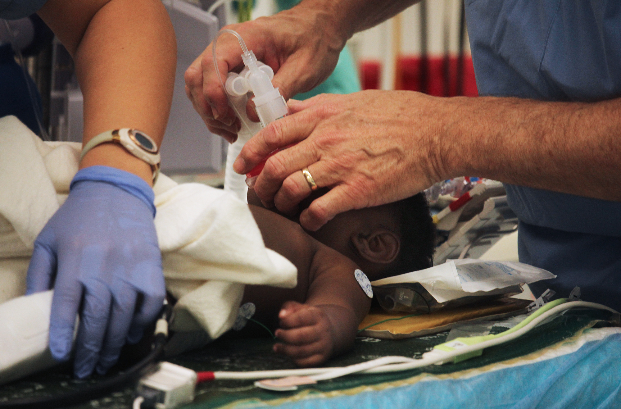 “Todo salió bien” La cirugía de corazón de un bebé de 6 meses fue todo ...